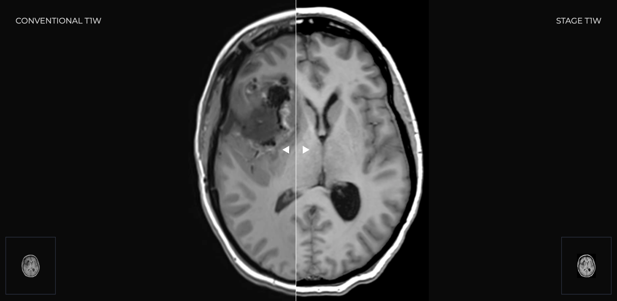 SpinTech MRI - cultivate(MD)